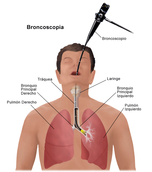 O que esperar quando você faz uma endoscopia pulmonar - Dr. Felipe Passos